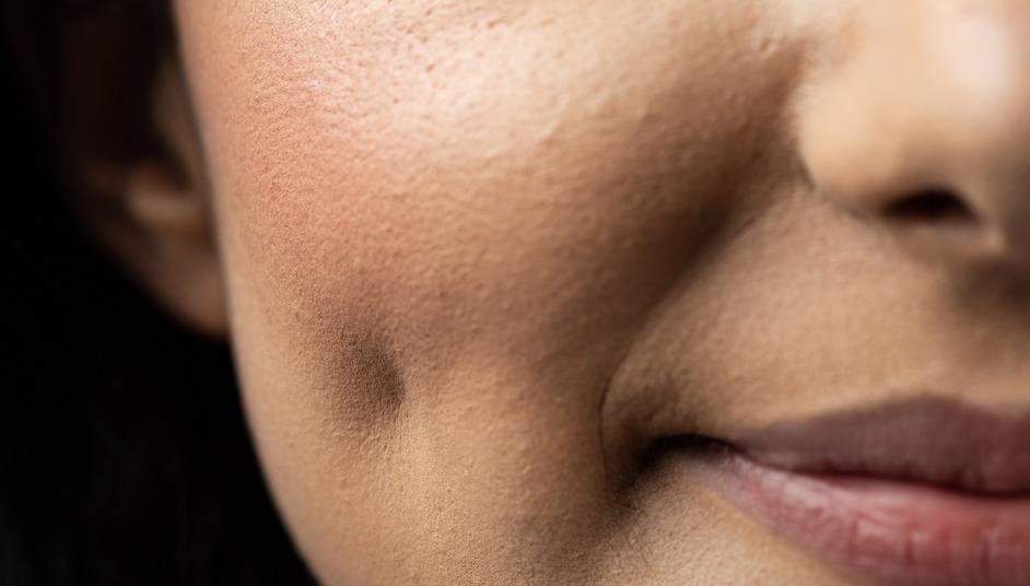 what-is-a-dimple-maker-social-media-s-at-home-dimple-trend