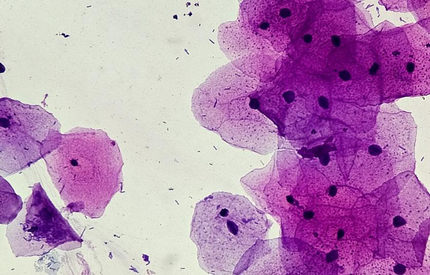 Bacterial Meningitis: Symptoms, How It Spreads, and More