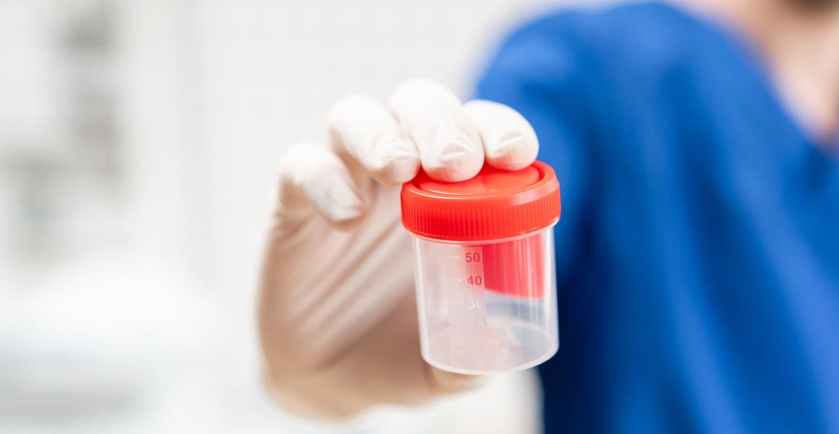 THC- and CBD-Infused Lube: Are They Worth It?