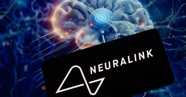 Neuralink Human Trials Are Underway: What We Know so Far