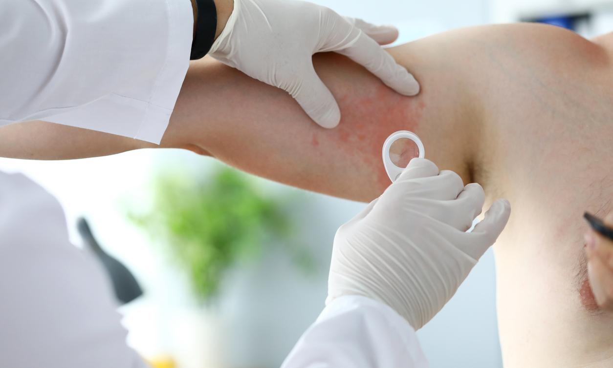 Why Does Lume Smell so Bad? Analyzing the Full Body Deodorant