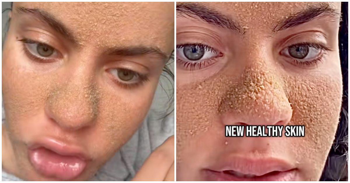 The Caveman Skin Method Is Going Viral on TikTok, But Does It Work?