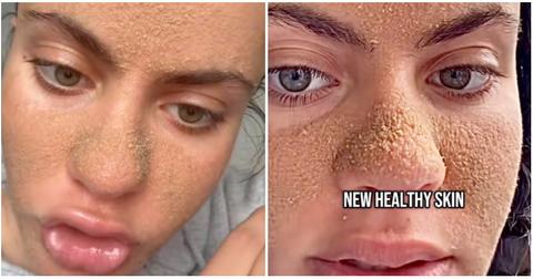 The Caveman Skin Method Is Going Viral on TikTok, But Does It Work?