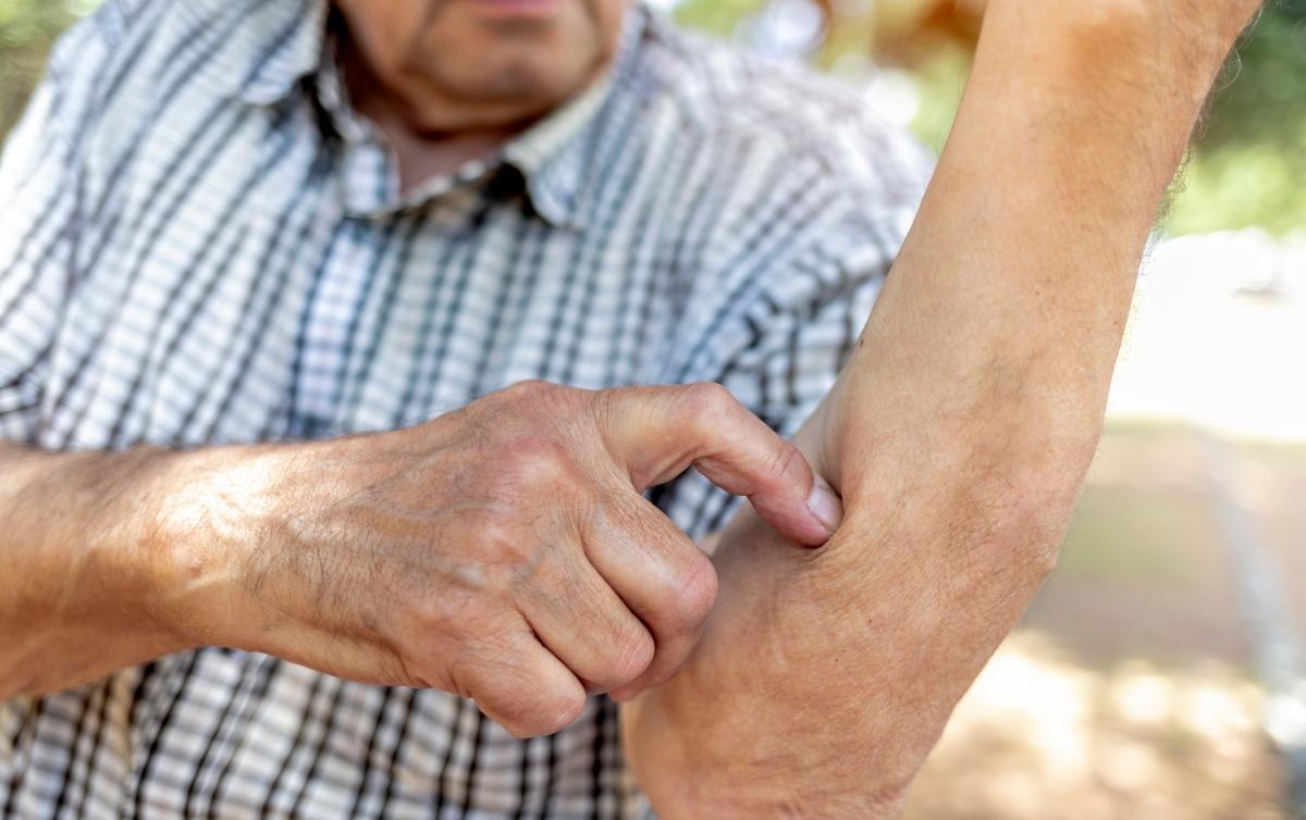 Why Is DEET Bad? How It Impacts Health and the Environment