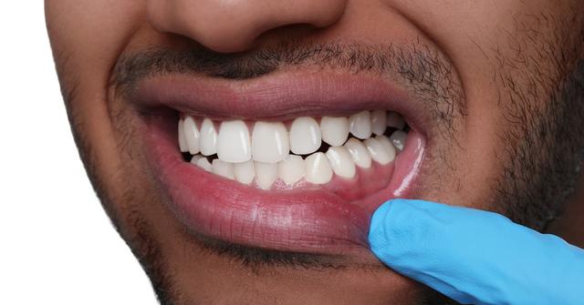 Is Sparkling Water Bad for Your Teeth? Details Here